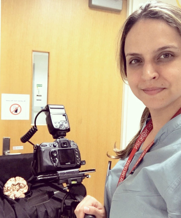 #43 Vanessa Milanese – Bridging Anatomy and Neurosurgery: A Deep Dive ...