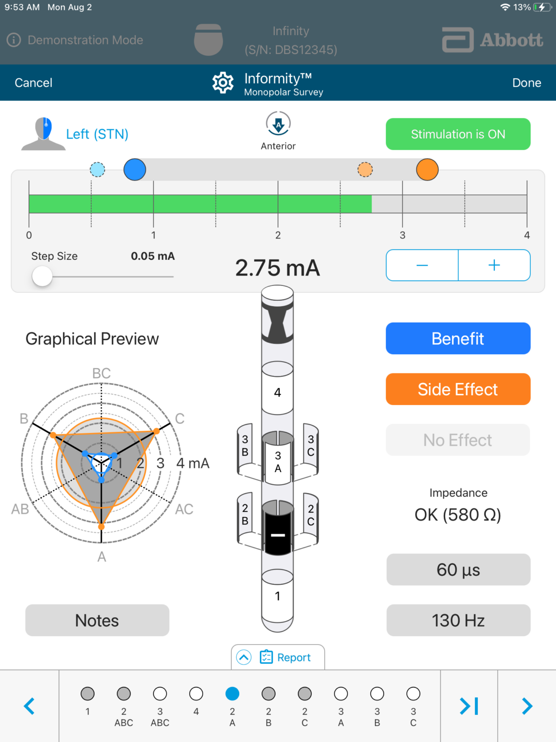 #48: Binith Cheeran: From Clinical Neurology to Industry Leader – Stimulating Brains
